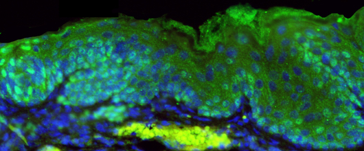 Biomedical Genetics - University of Rochester Medical Center