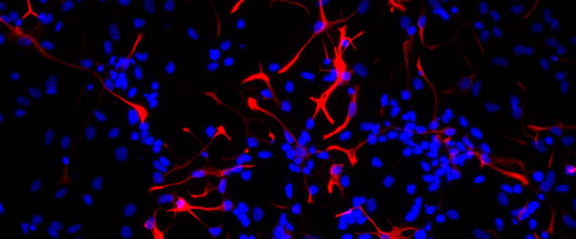Biomedical Genetics - University of Rochester Medical Center