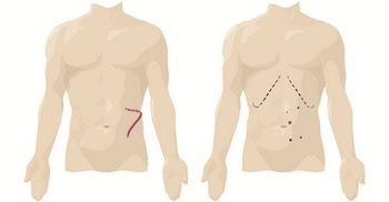 Urology Procedures - Robotic Surgery - Highland Hospital - University ...
